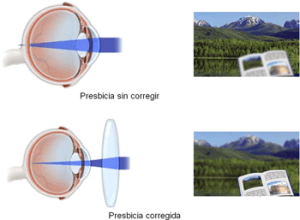 La Presbicia - Optica del Notariado